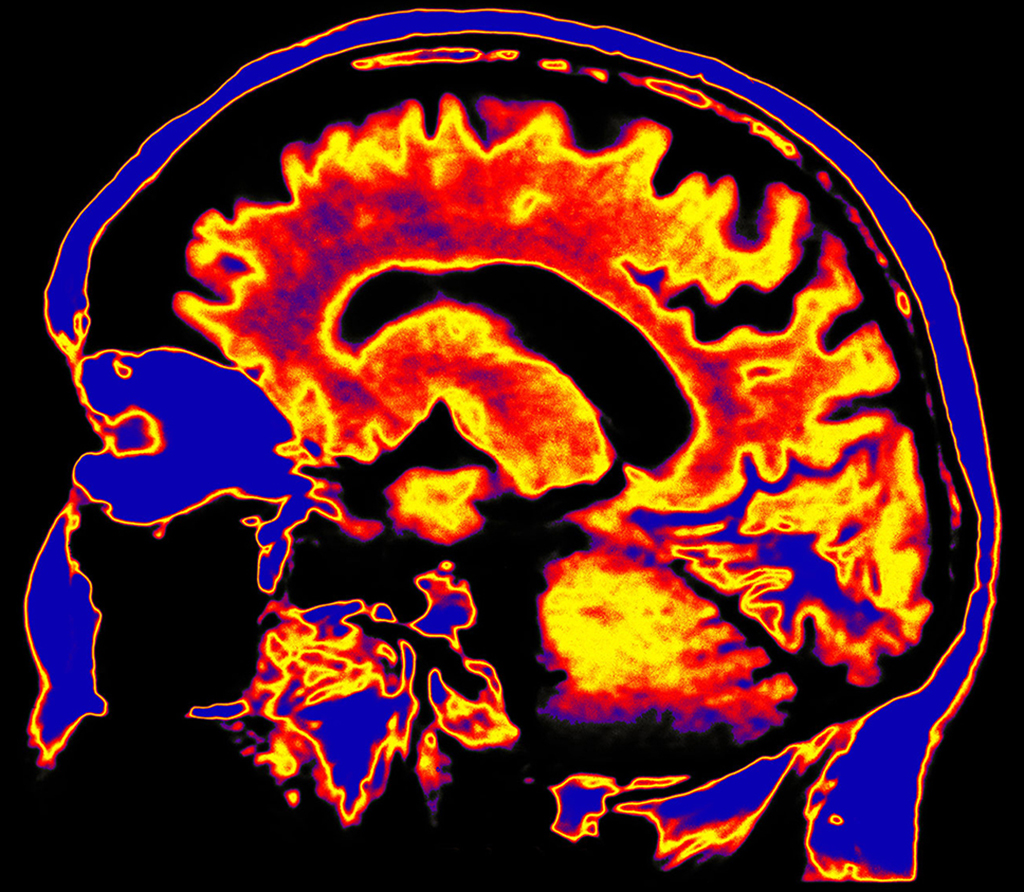 Improving the reproducibility and understanding of MRI scans - NPL